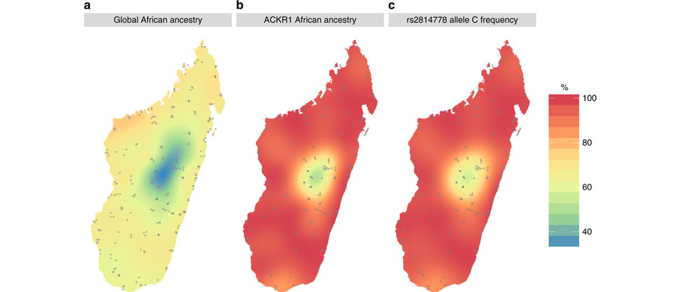 Signal of recent positive selection for African ancestry in the admixed ...